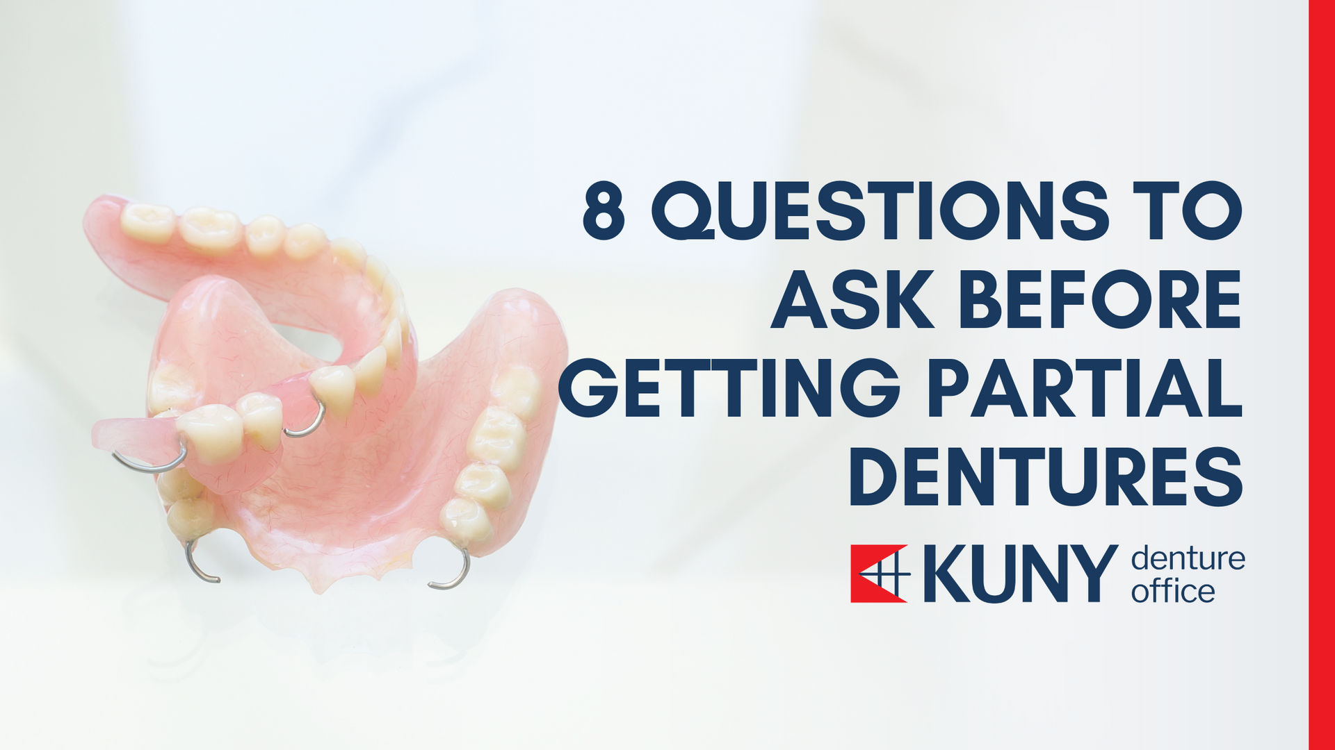 8 Questions to Ask Before Getting Partial Dentures