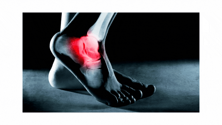 Neuropathy Treatment – Cary, NC – Cary Spine Clinic