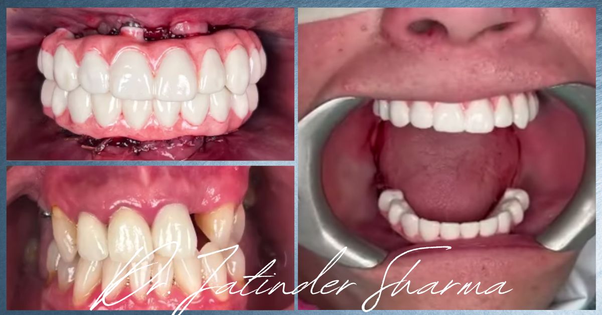 Signature Smiles: Family, Cosmetic, Emergency Dentists in Manchester