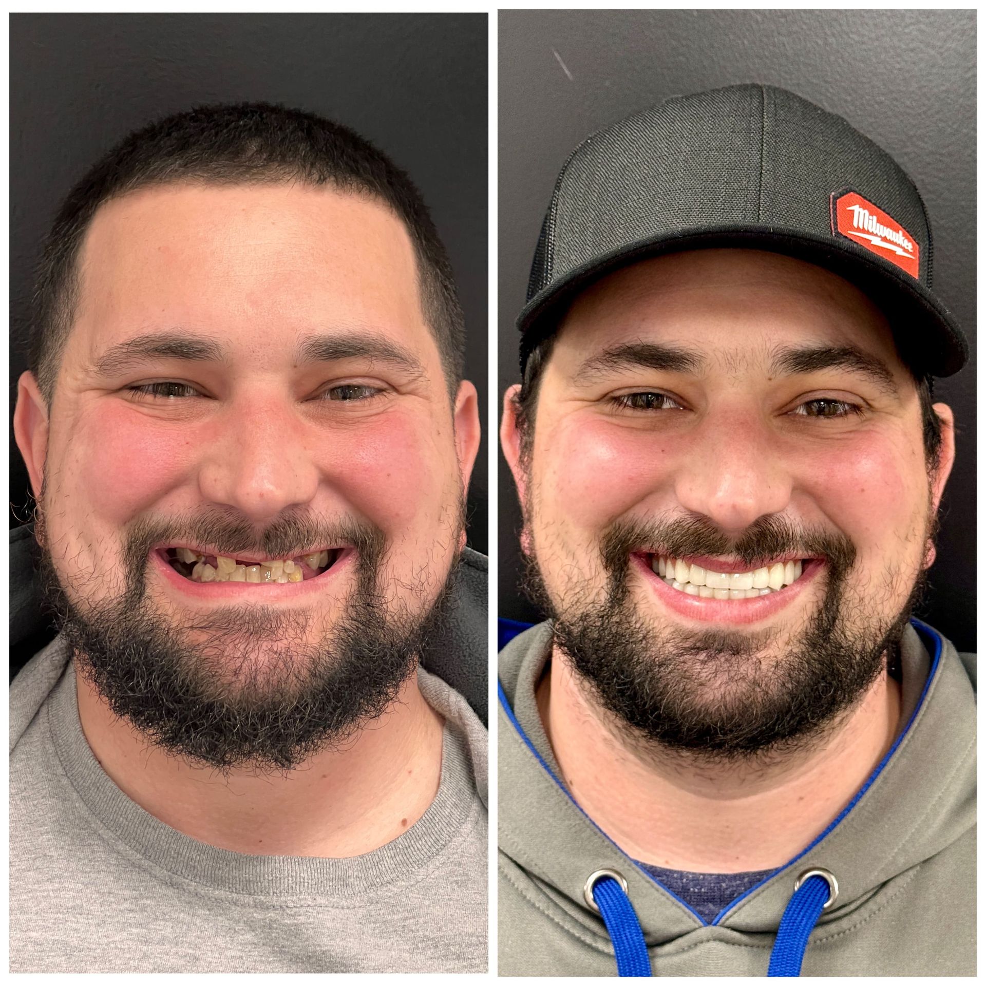 Signature Smiles: Dental Implants Smile Gallery Manchester CT