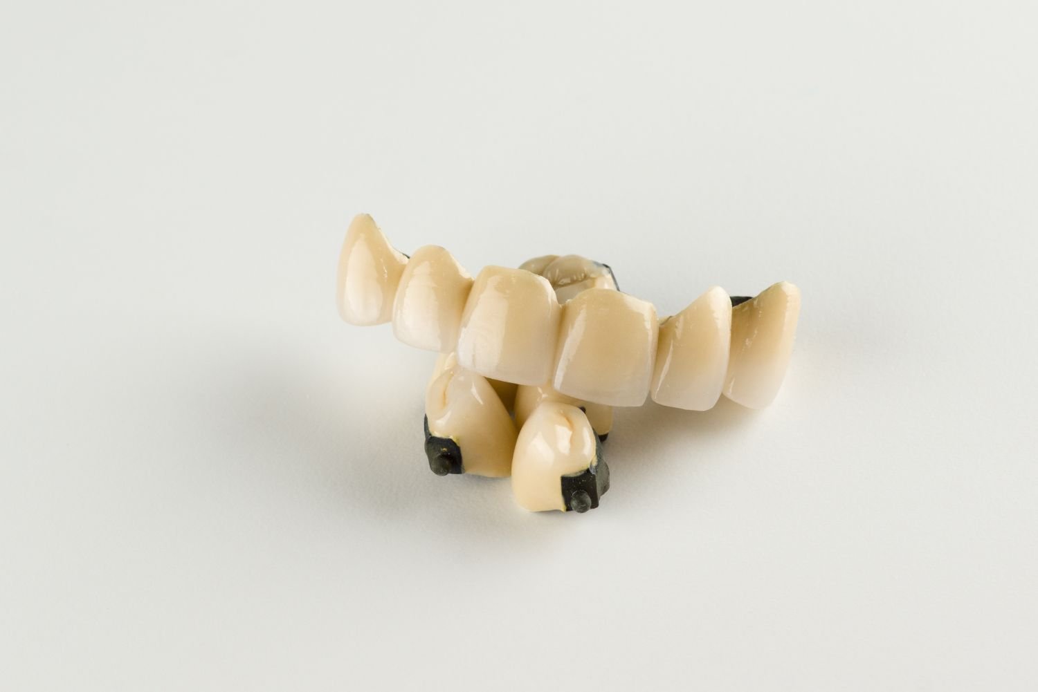 Porcelain Fixed Bridges | Glen Carbon, IL