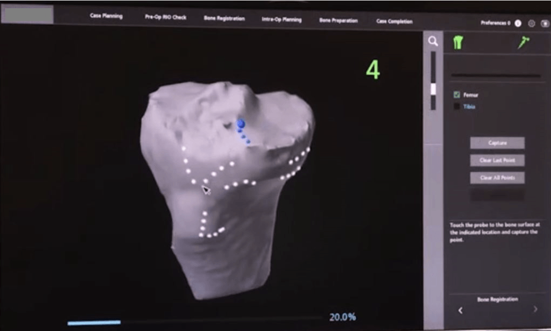 Our Technology | About | Dr Neil Ferguson | Specialist Hip and Knee ...