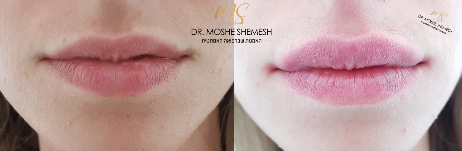 DR. MOSHE SHEMESH