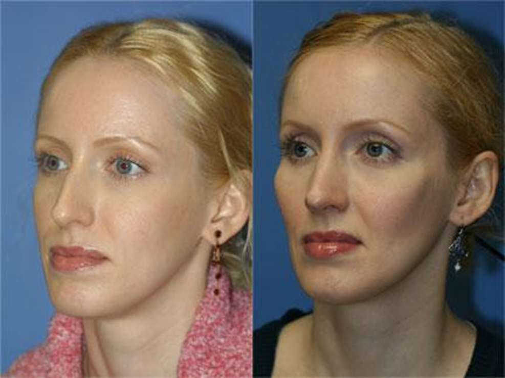 Safe Oral Cosmetics Surgery in D.C. | D.C. Surgical Arts