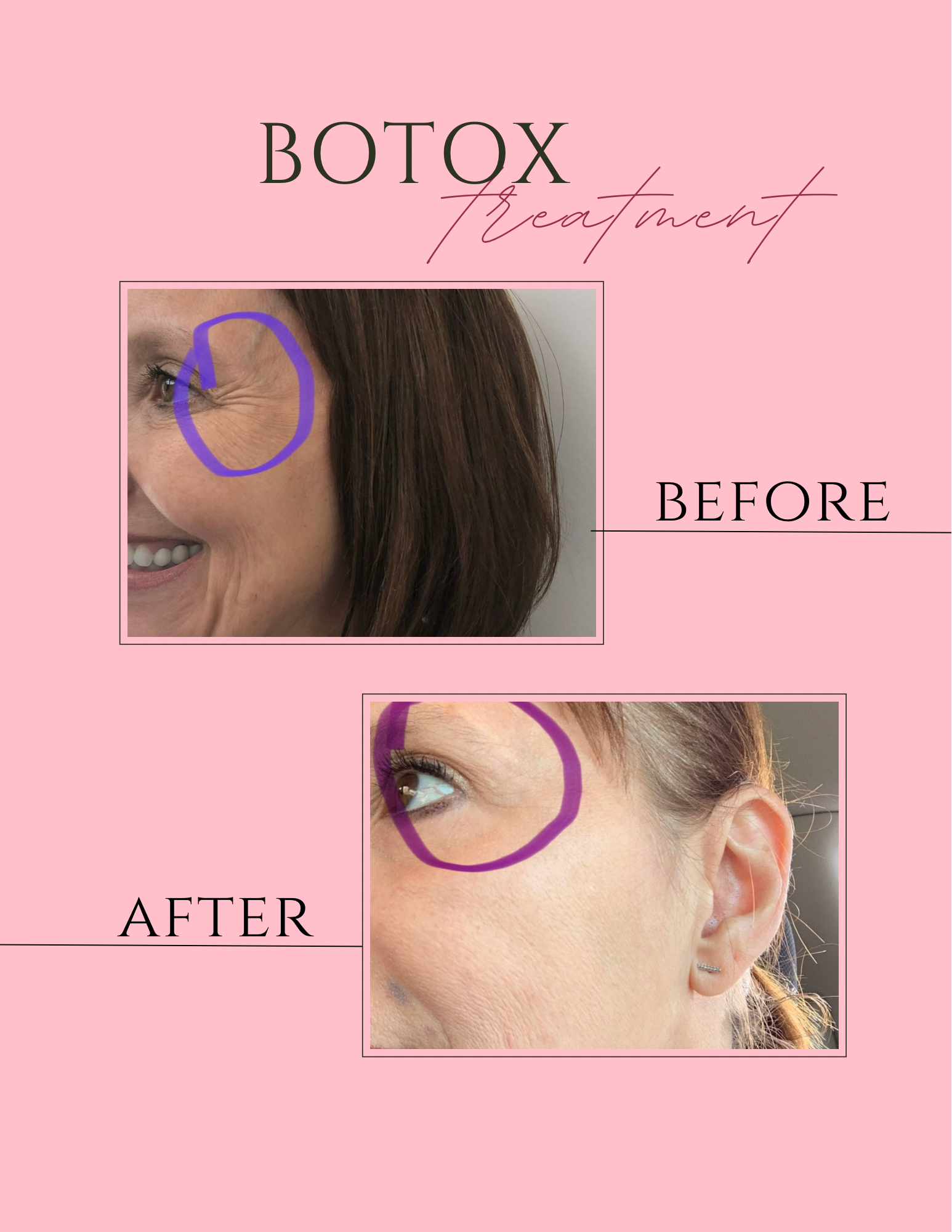 Smile Transformations | Nutley, NJ