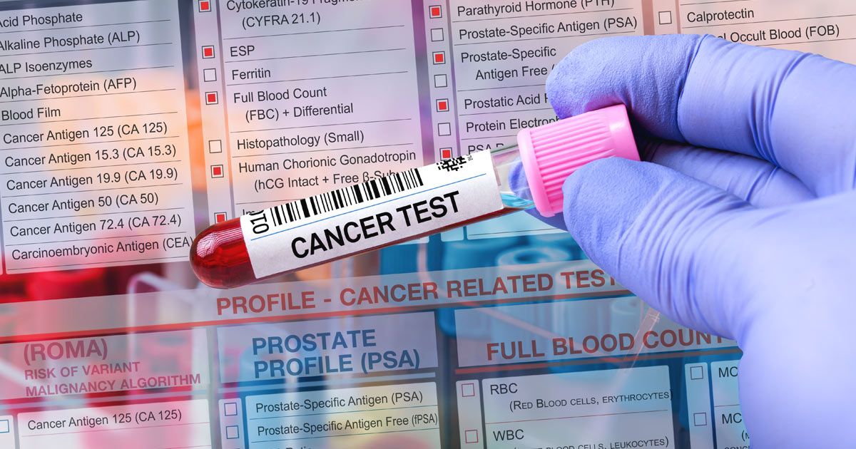 Advanced Cancer Screening Test NYC - Dr. John Salerno