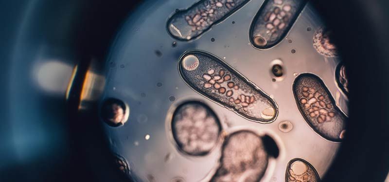 Parasite Infections - How Functional Medicine Navigates Parasite Infections