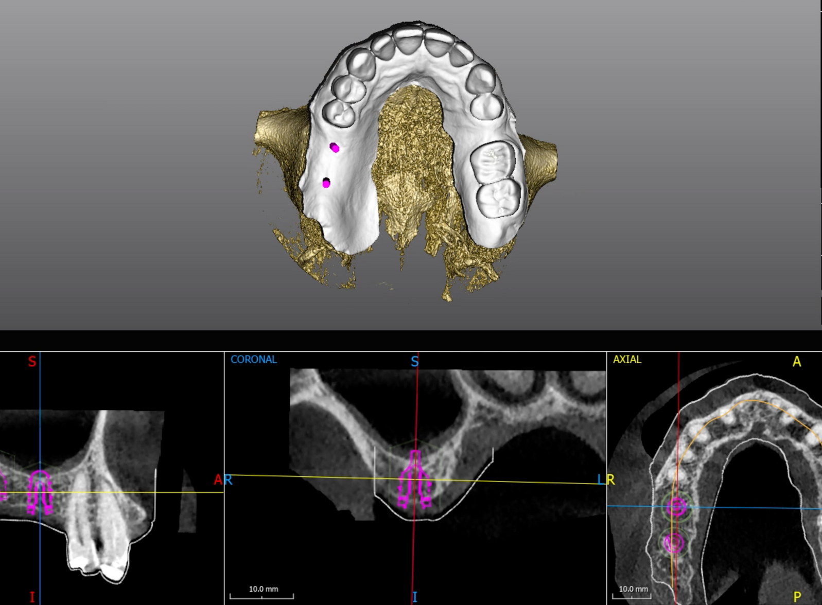 Cambridge Novolab Dental Laboratory | HOME | Dental Laboratory ...