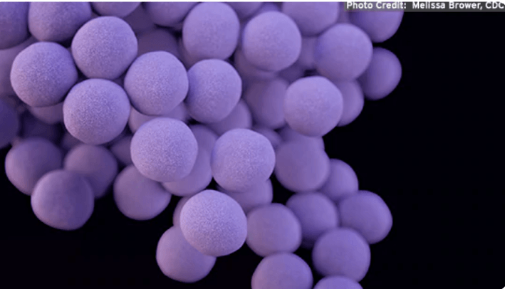 Stafilokokne intoksikacije