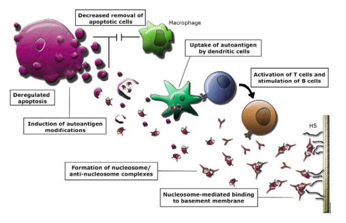 Sistemski lupus eritematozus (SLE)