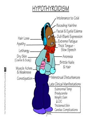 HIPOTIREOIDIZAM vs HIPERTIREOIDIZAM