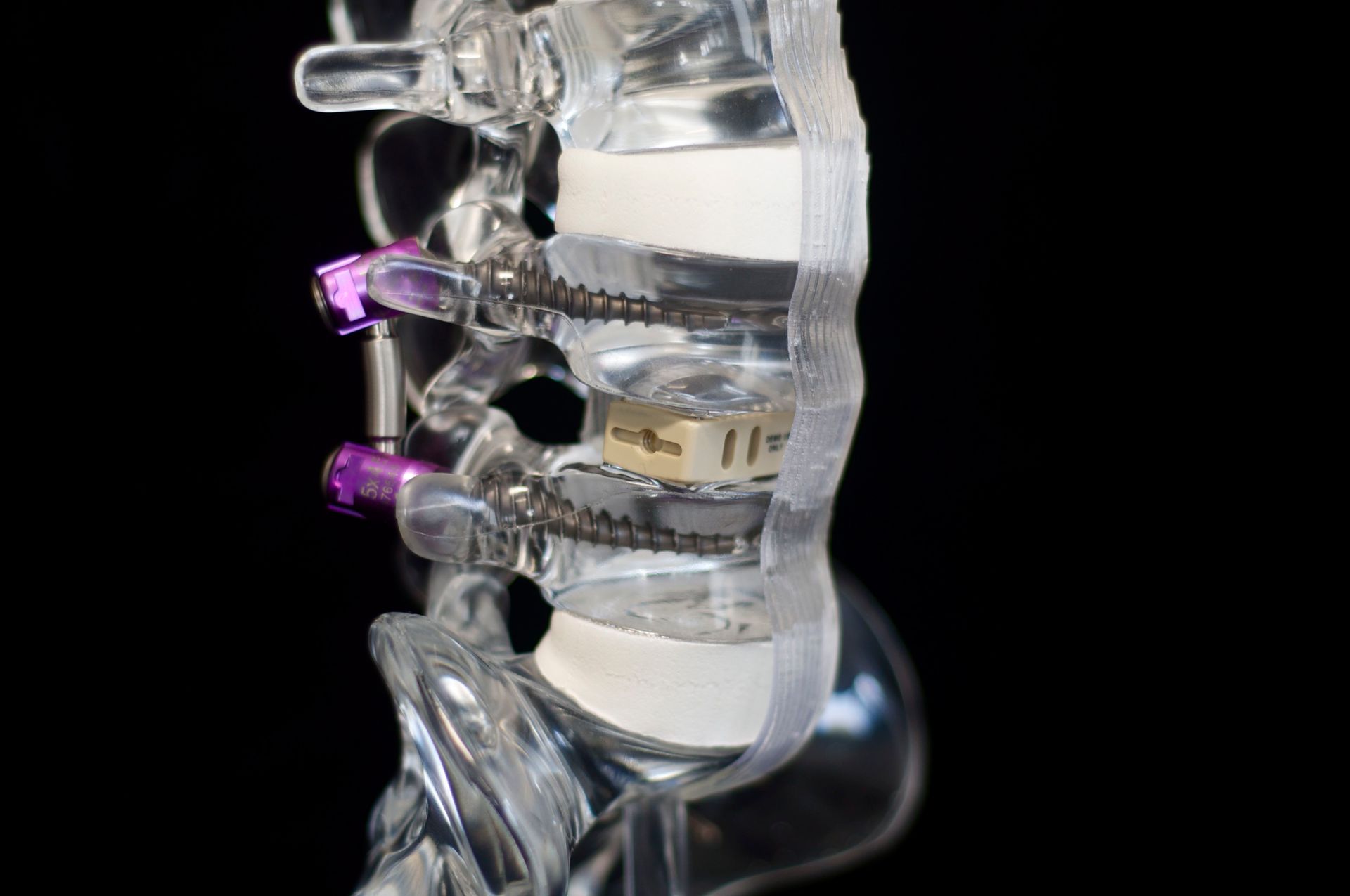 Neuro-Spine Models & Surgical Procedures | Melbourne