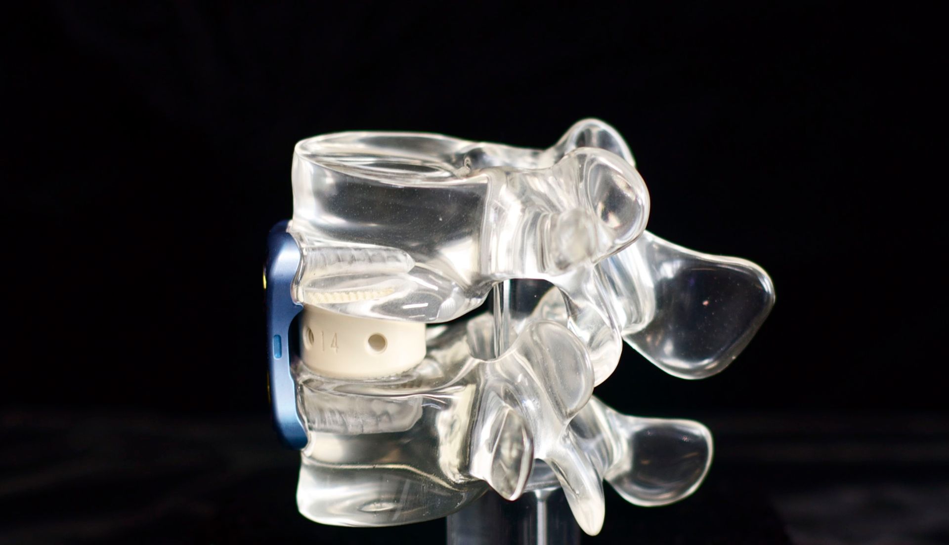 Neuro-Spine Models & Surgical Procedures | Melbourne