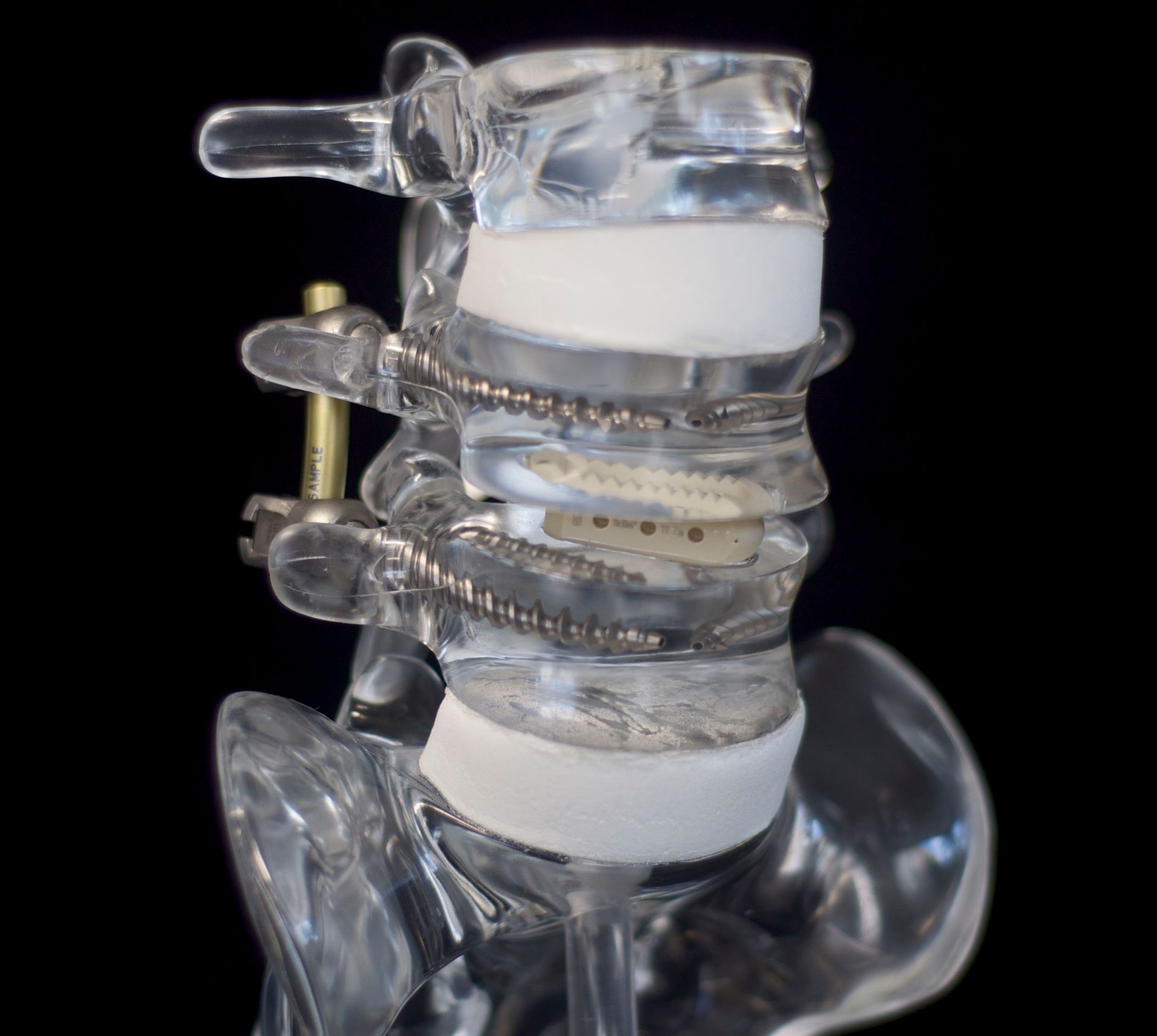 Neuro-Spine Models & Surgical Procedures | Melbourne