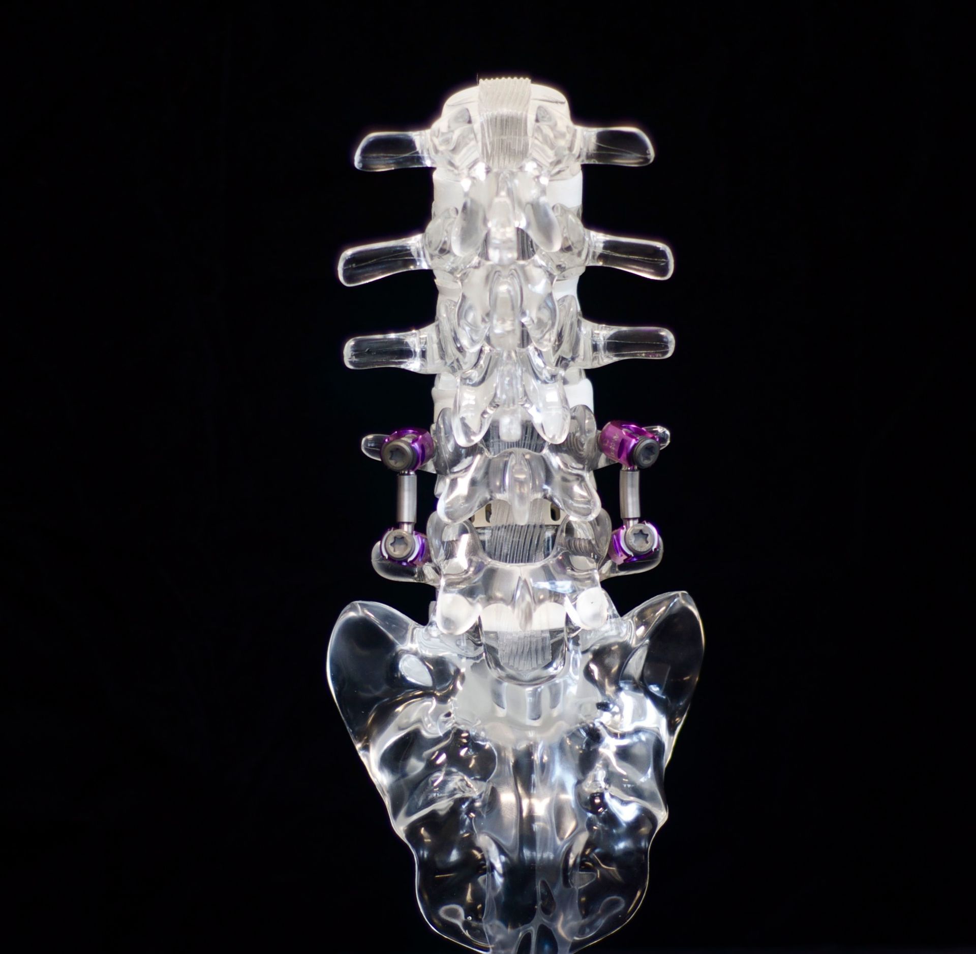 Neuro-Spine Models & Surgical Procedures | Melbourne