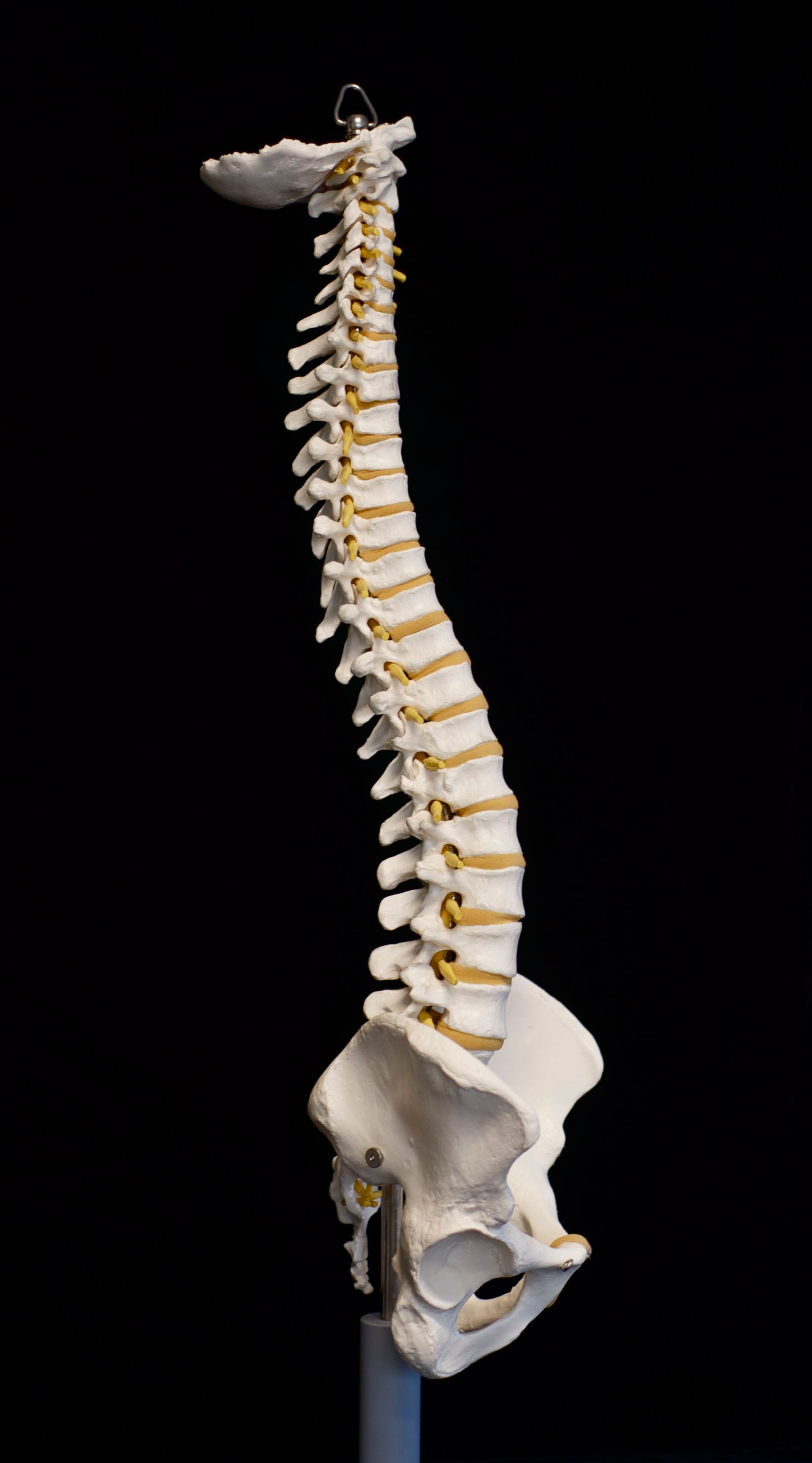 Neuro-Spine Models & Surgical Procedures | Melbourne