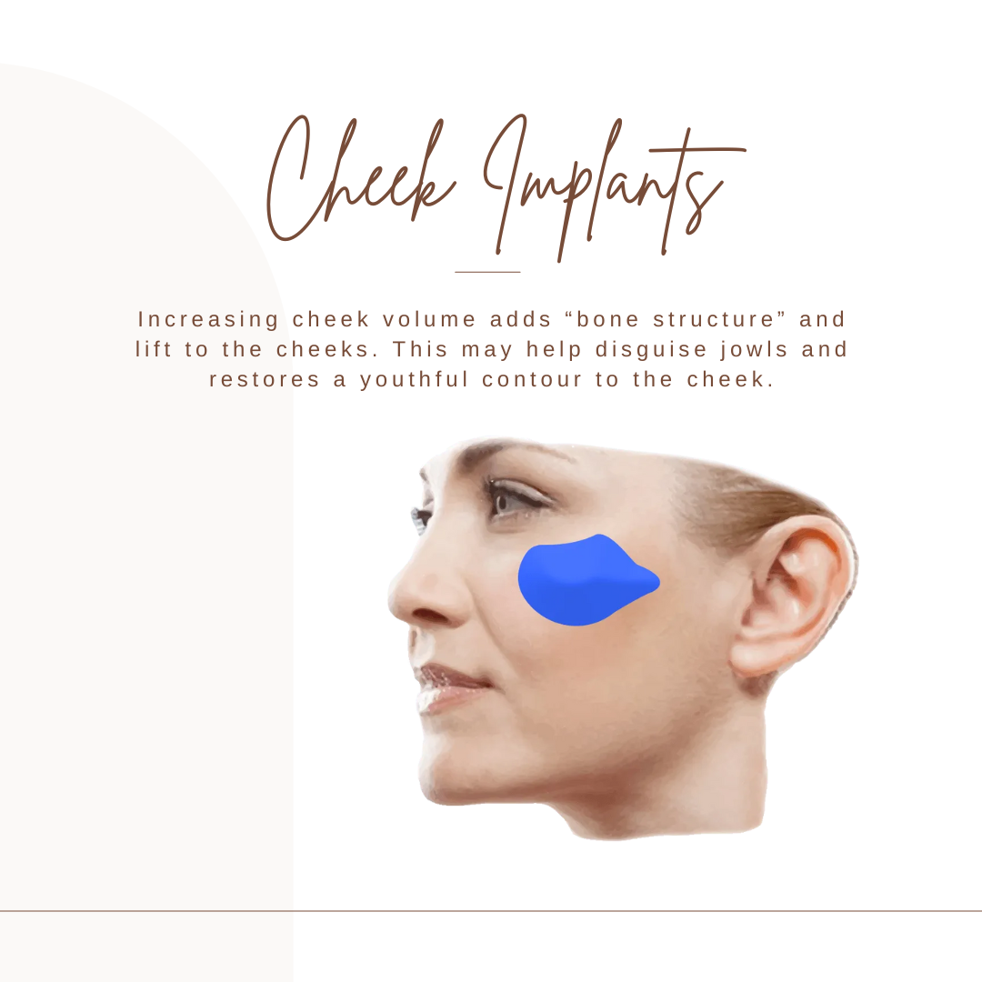 Achieve A Sculpted Face With Facial Implants