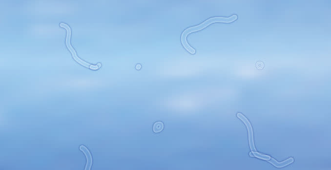 Eye Floaters… What are they?