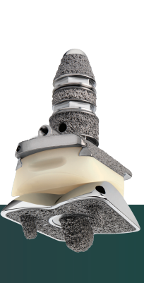 Total Ankle Replacement in Lancaster, CA | Stryker InBone® & Infinity ...