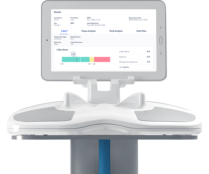 SOZO Body Scan | Body Fluid Analysis | Lymphoedema Treatment