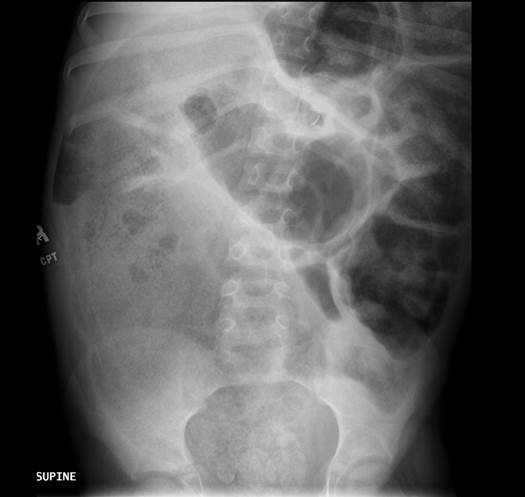 COLORECTAL QUIZ: April 4, 2022