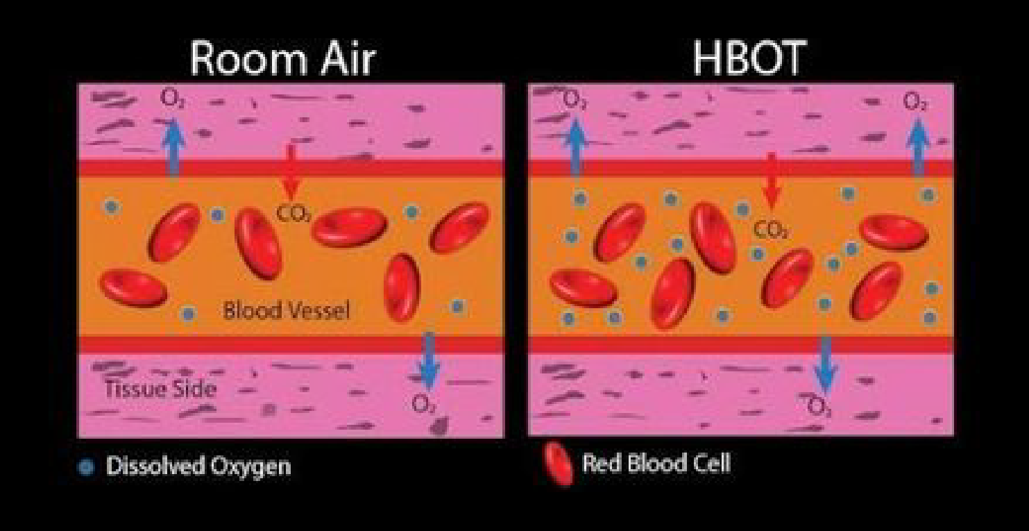 Low Pressure Hyper Cube | Westminster, CO | Amazone Functional Health