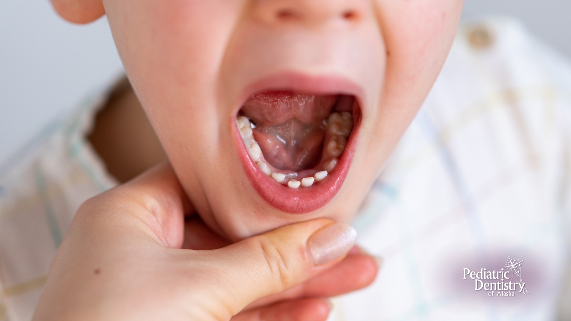 Tooth Eruption Schedule: A Guide for Parents