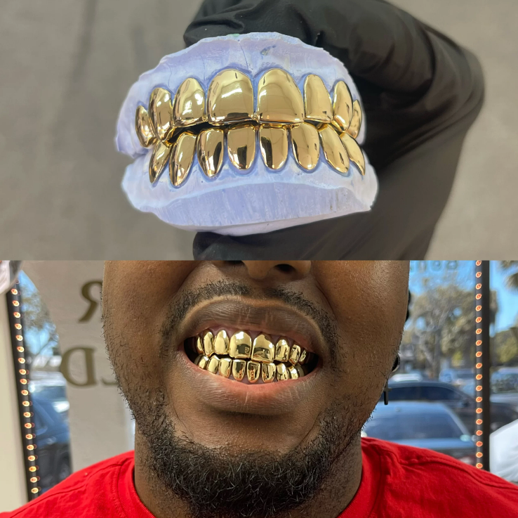Check Out Our Unique Grillz | Benzino Jewelry & Gold