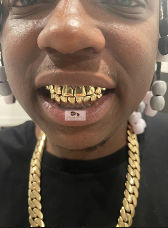 Check Out Our Unique Grillz | Benzino Jewelry & Gold