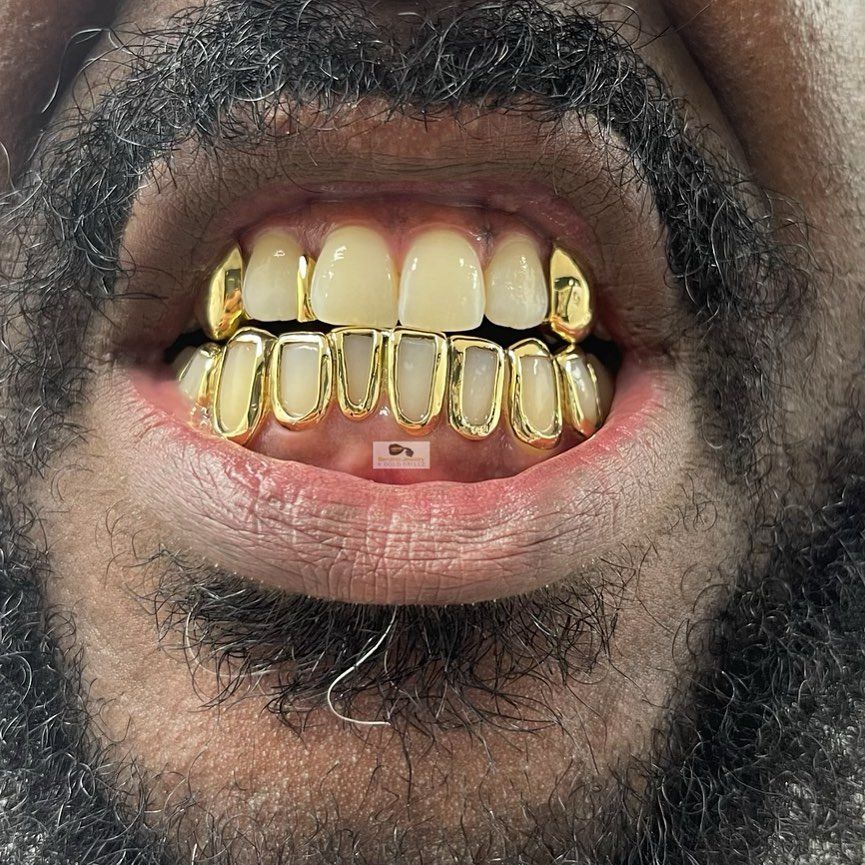 Benzino Jewelry & Gold Grillz | Custom Gold Grillz