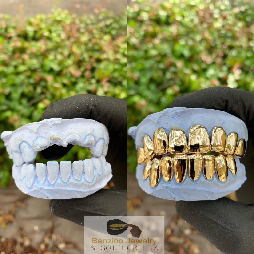 Check Out Our Unique Grillz | Benzino Jewelry & Gold