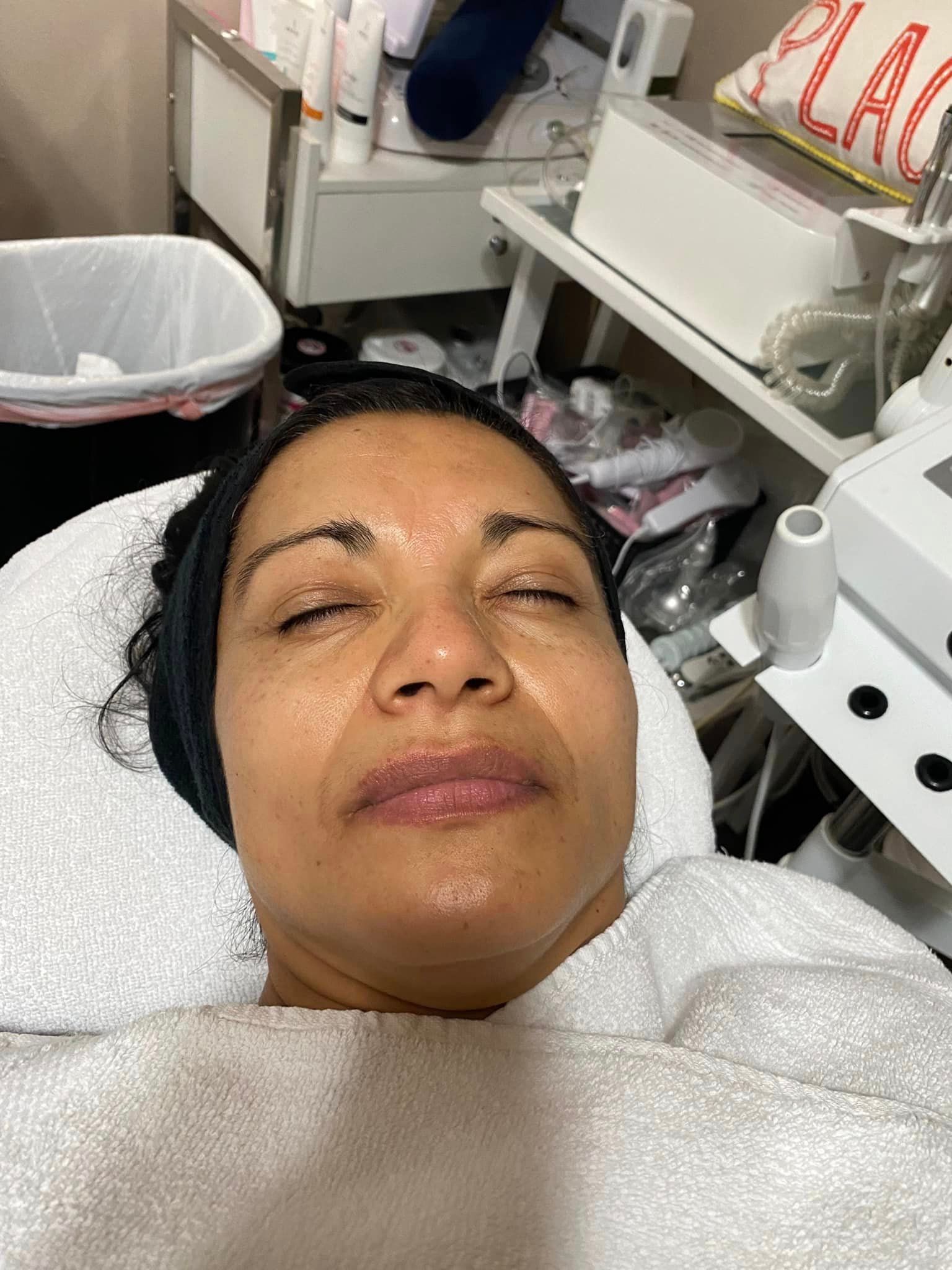 Facial Sense Skin Care - Galt CA