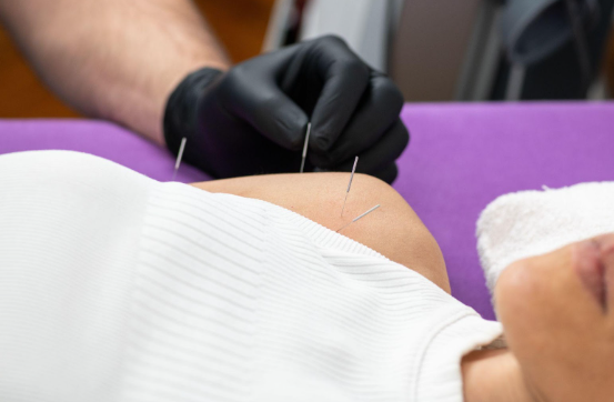 How Does Dry Needling Work?