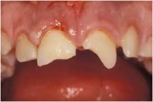 Dental Emergencies: Knowing what to do can lessen the trauma