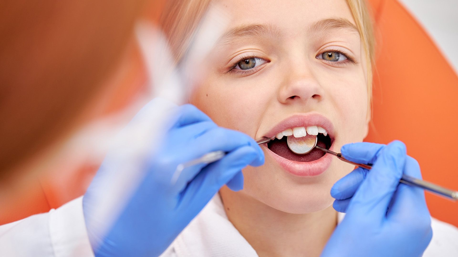 How Often Should a Child Have Dental Check-Ups? A Guide