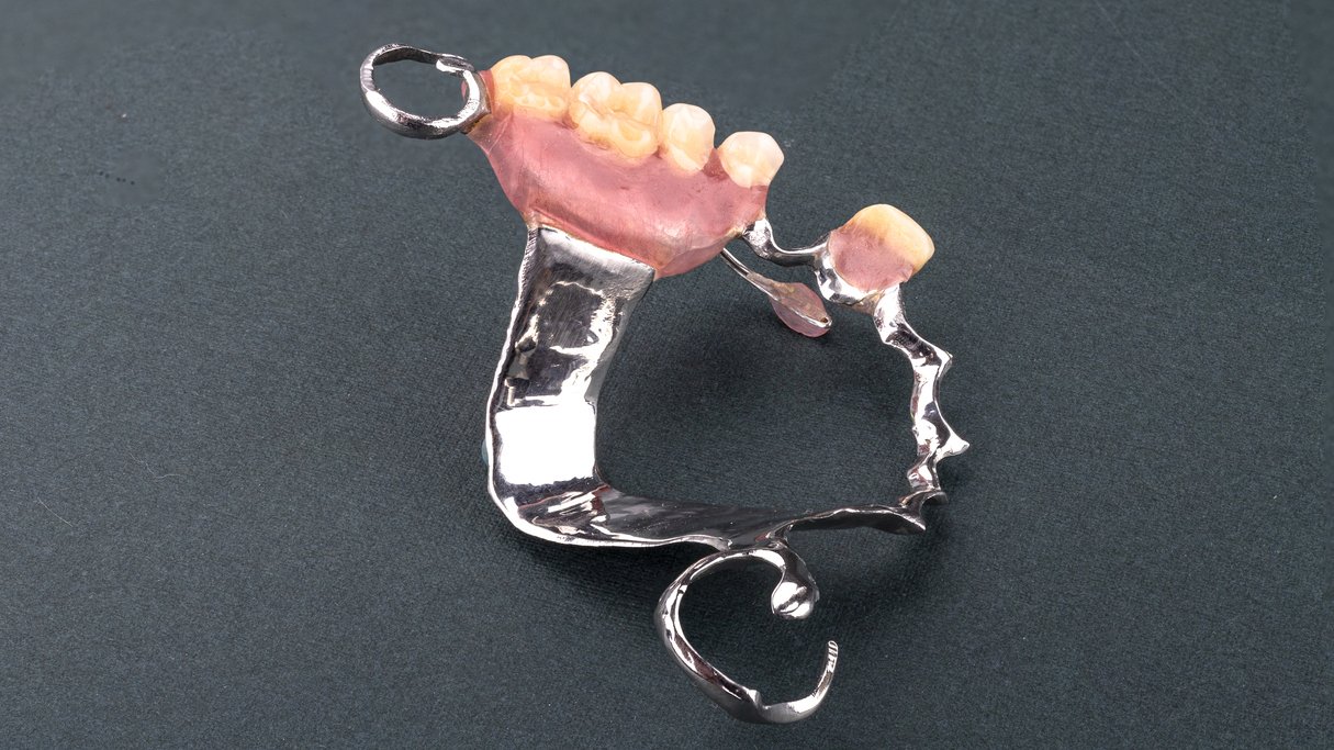 Zobārstniecības klīnika Electa | Protezēšana