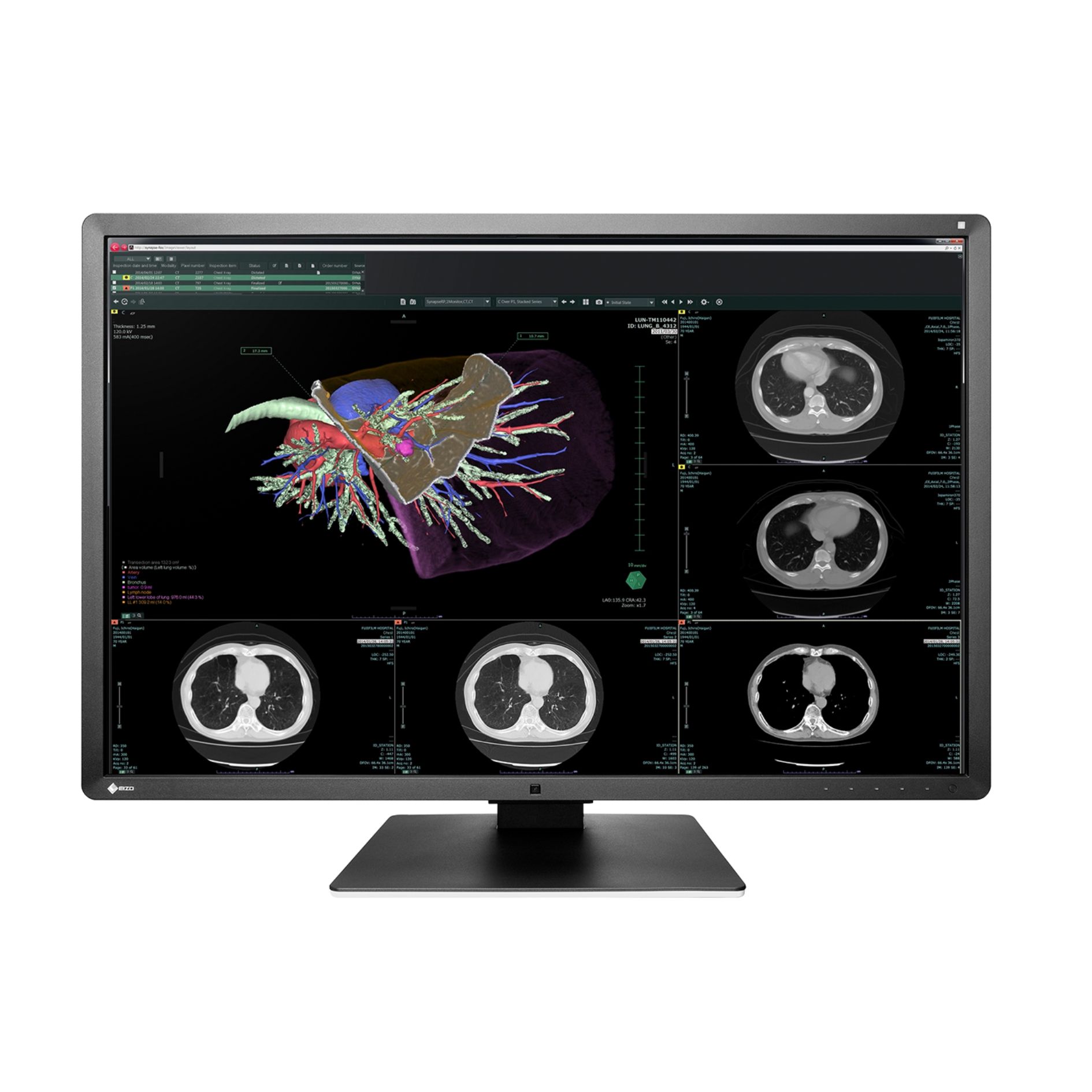 MRI Machines | North America | Radiological Imaging Services