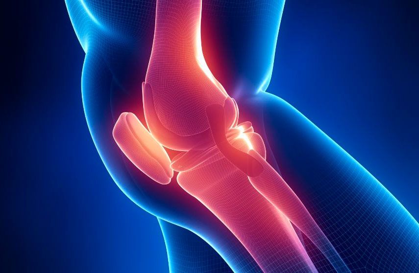 Genicular Artery Embolization | MM Medical