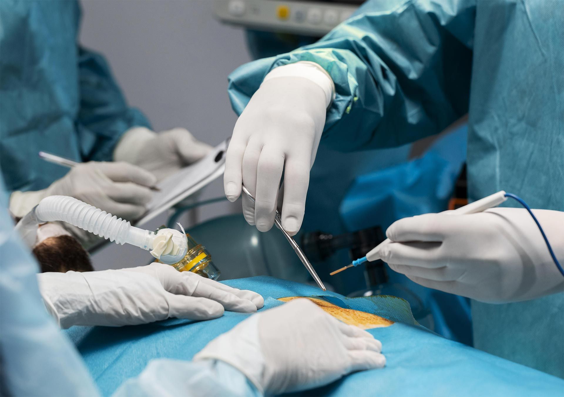 Interventional Vascular Surgery | Minimally Invasive Blood Flow Treatment