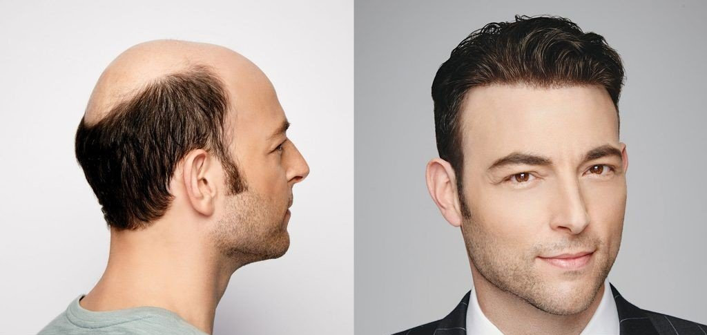 Hair Solutions | Minneapolis, MN