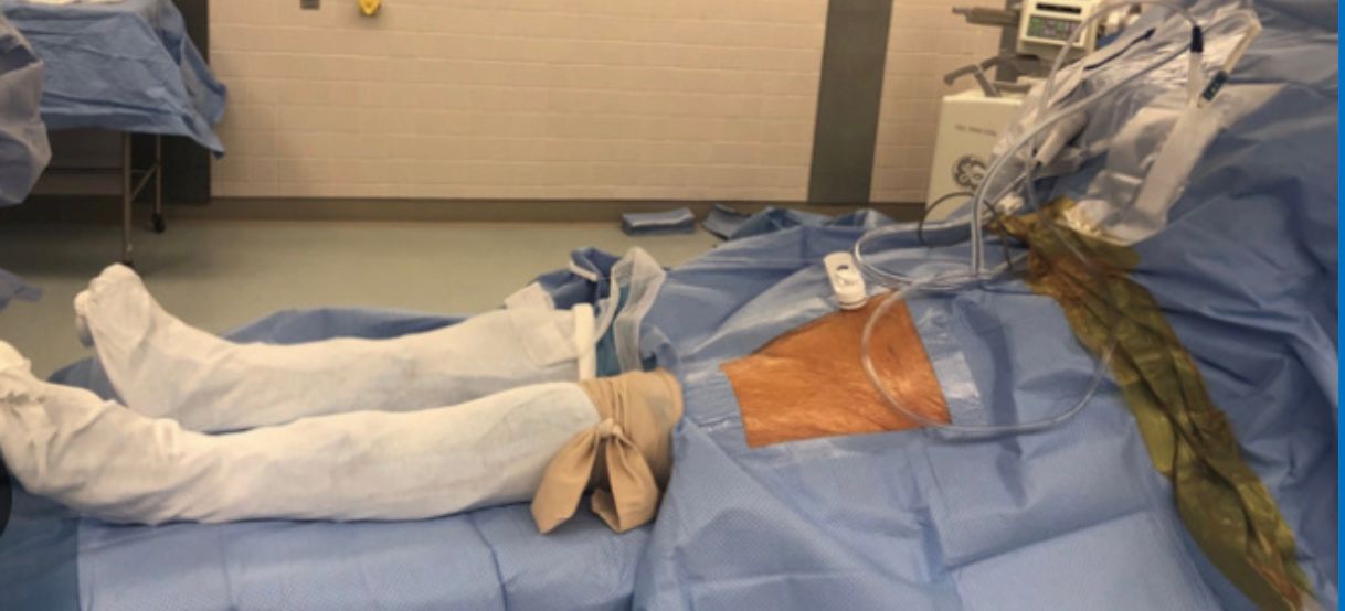 Direct Anterior Hip Replacement Gold Coast | David Agolley Direct Anterior Hip Replacement Gold Coast | David Agolley