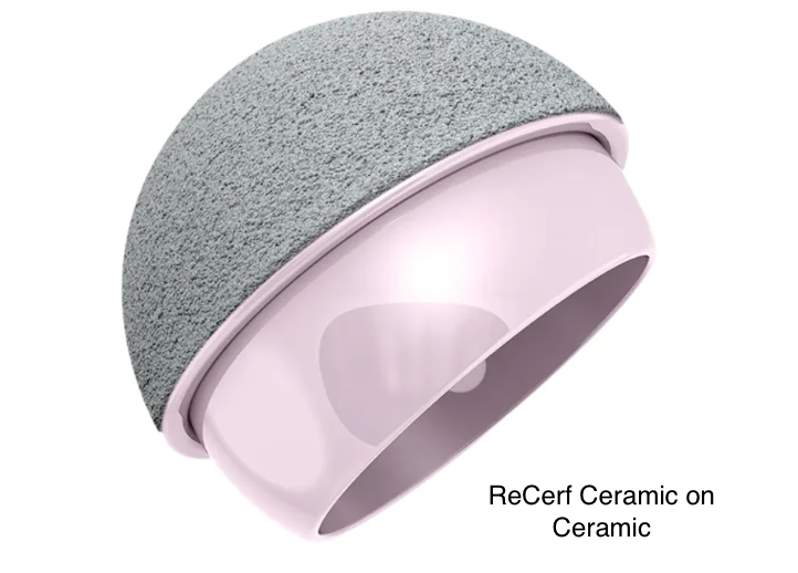 Hip Resurfacing | David Agolley Orthopaedic Surgeon