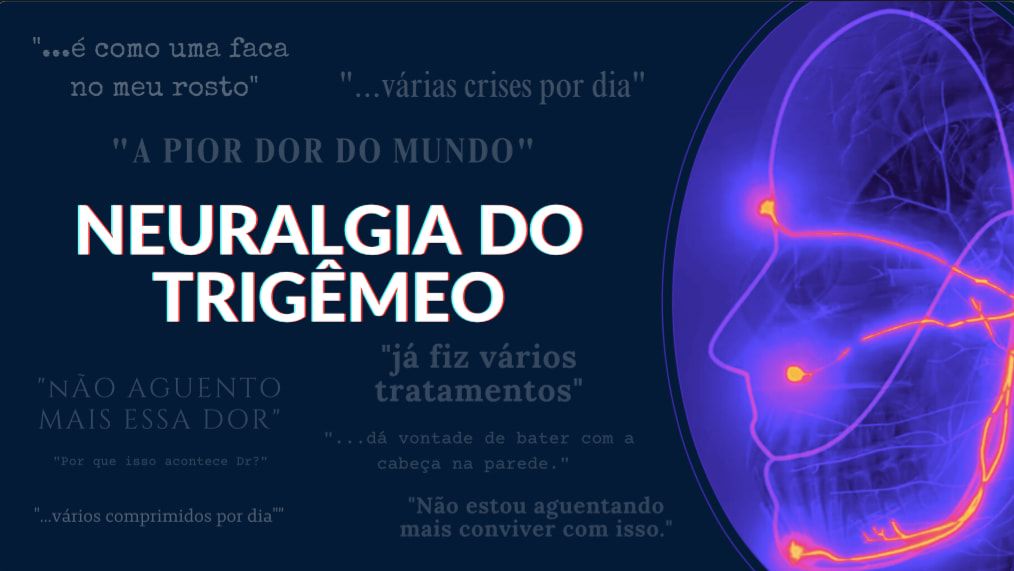 Cirurgia para Tratamento de Neuralgia do Trigêmeo | Dr. Irlon