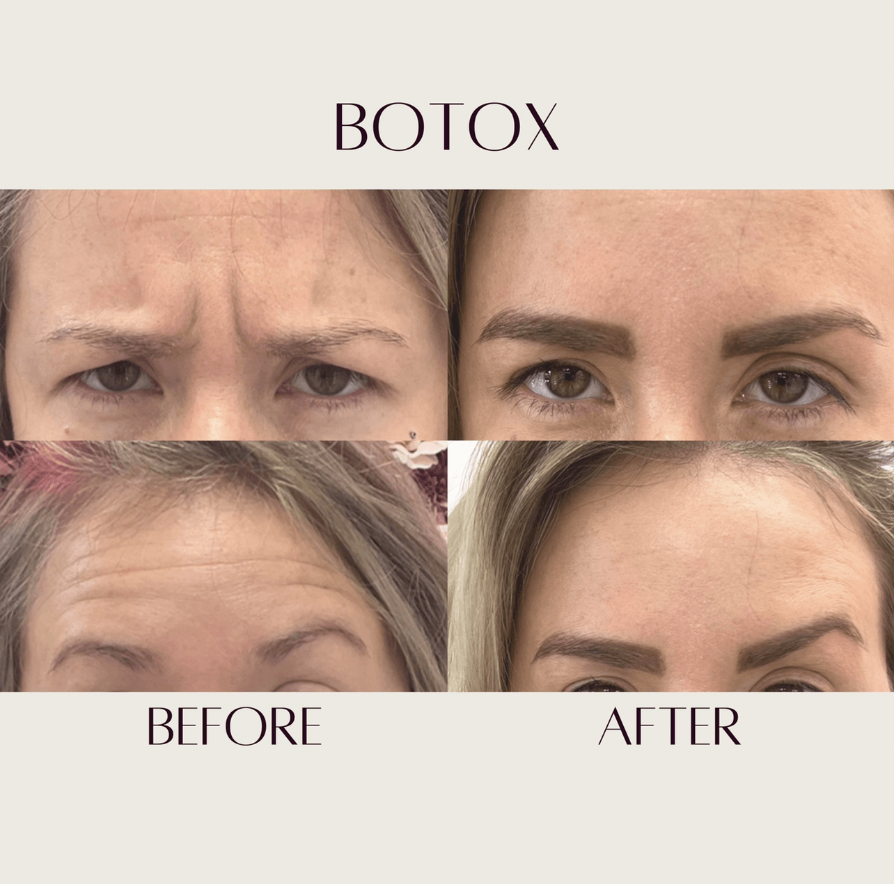 Med Spa in Los Angeles, CA