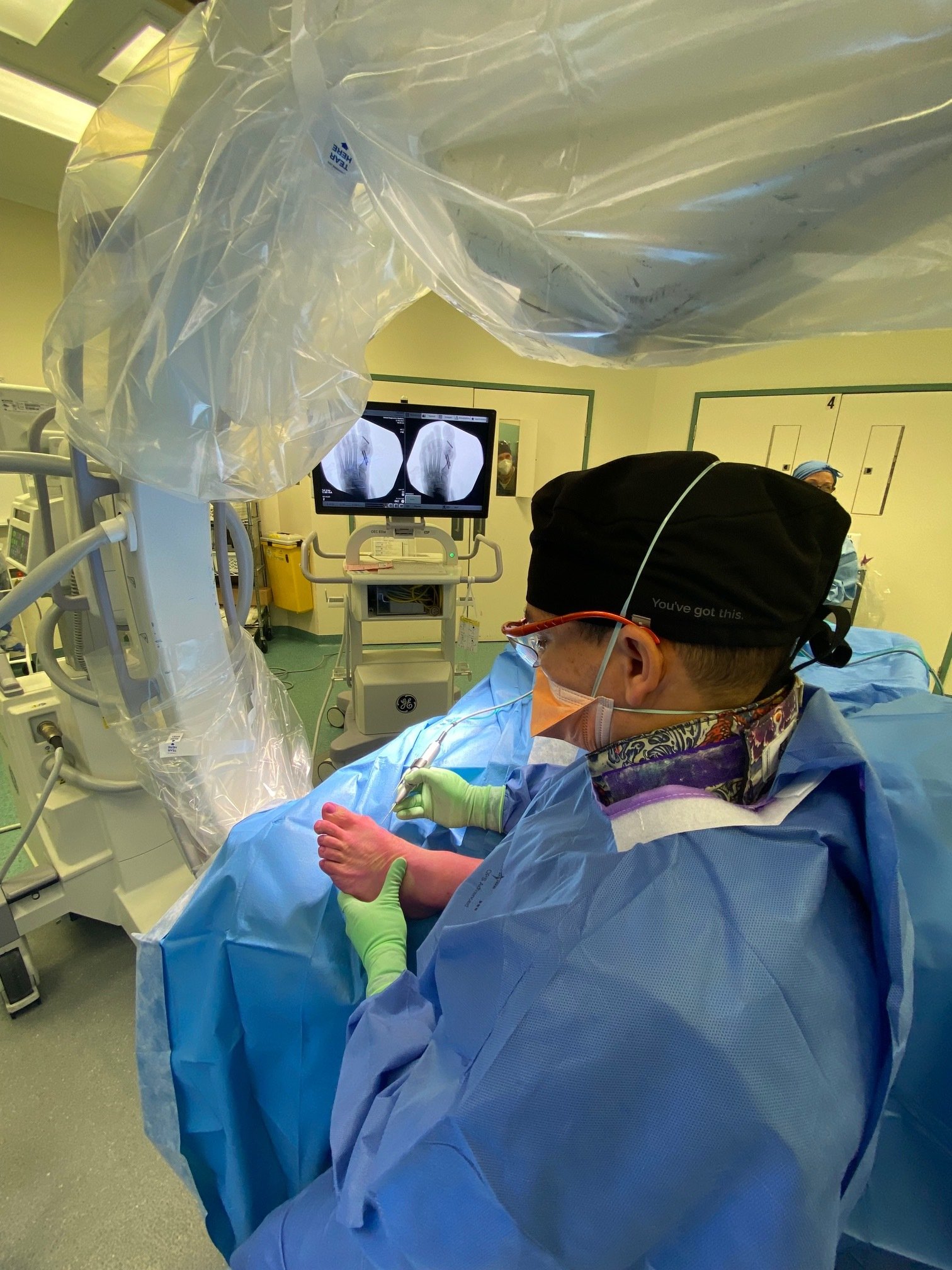 Bunion Surgery - Bunbury Foot & Ankle Surgeon