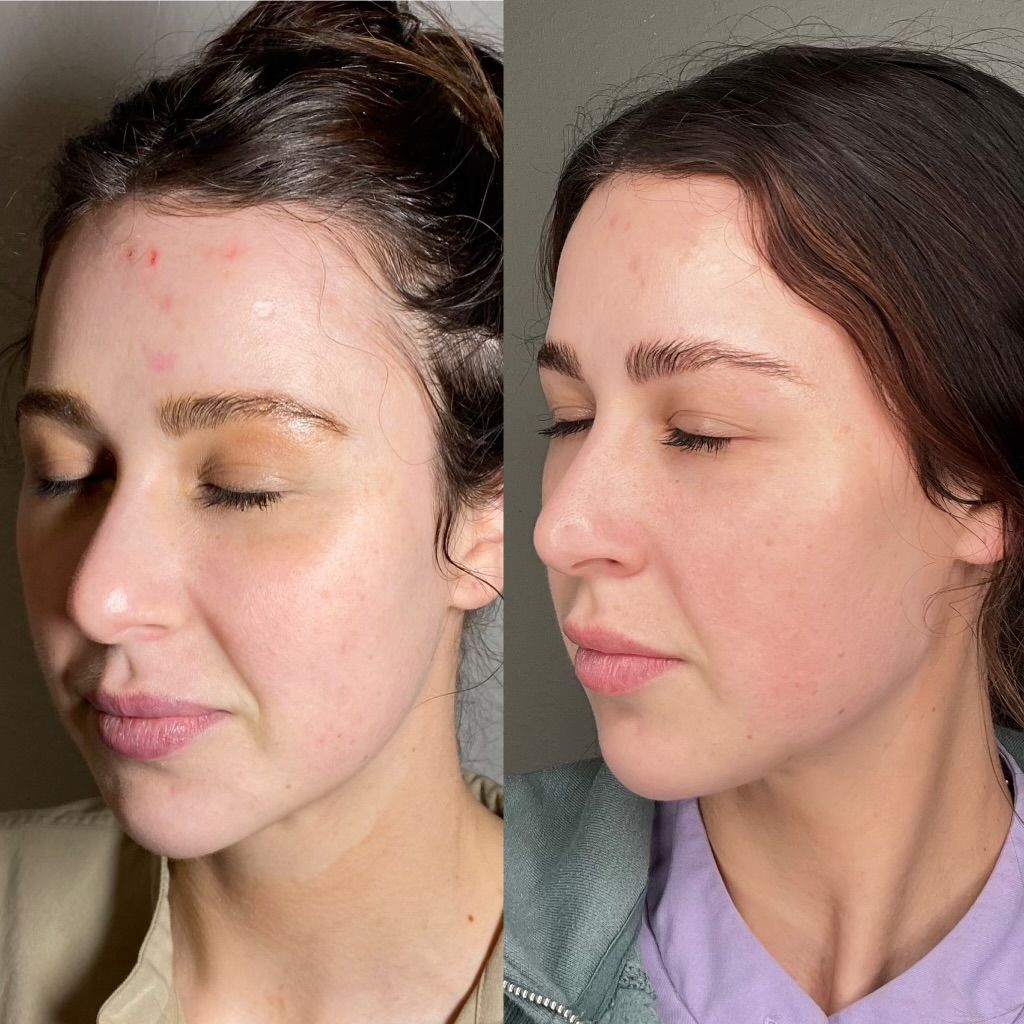 Pure Brilliance by PDO Max | PDO AfterGlo + LúmEnvy + Glowpin