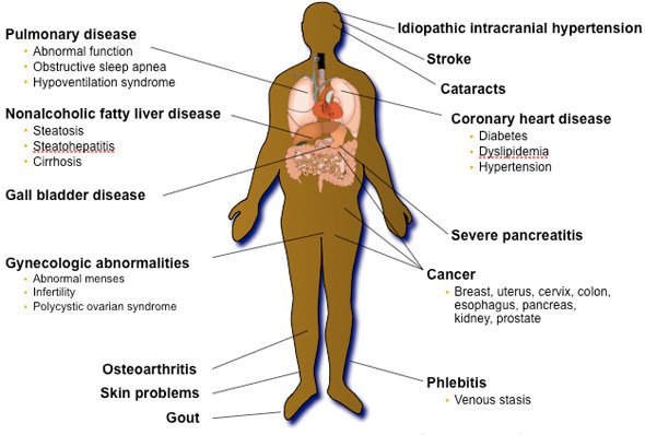 Causes & Consiquences of Obesity | Dr Michael Hatzifotis | Surgery Brisbane