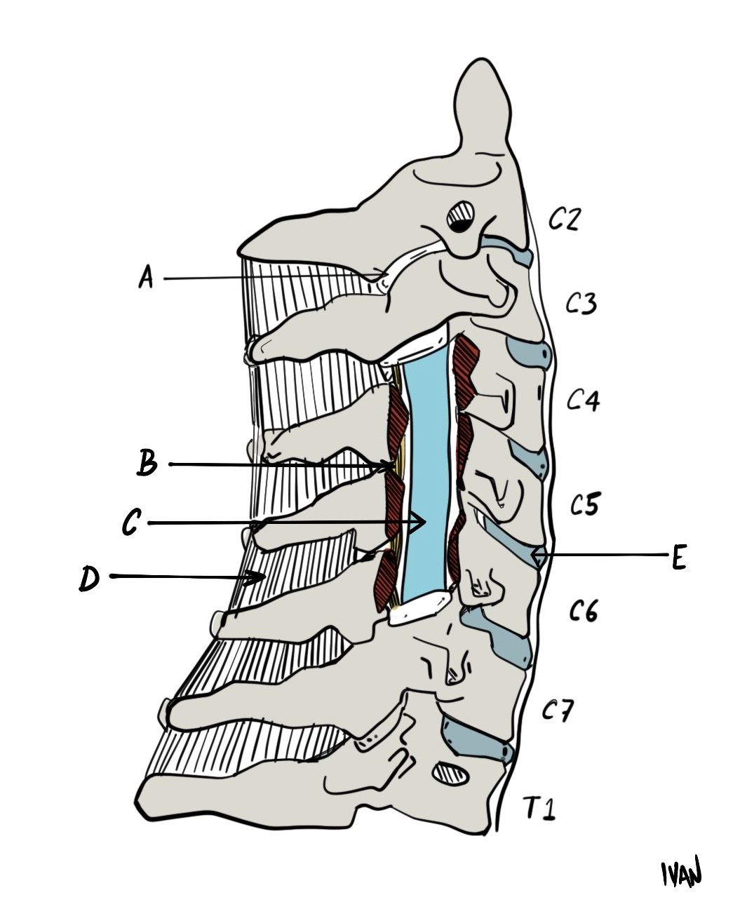 Cervicalgia | Dr. Ivan Rocha