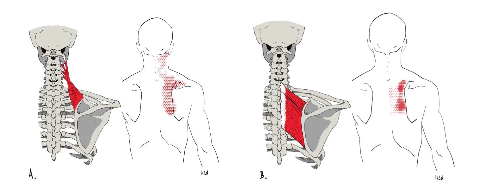 Cervicalgia | Dr. Ivan Rocha
