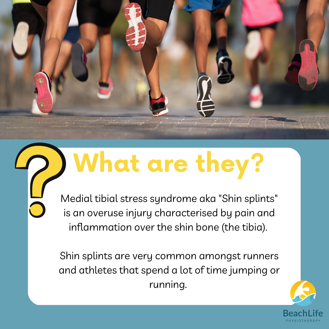 Shin Splints
